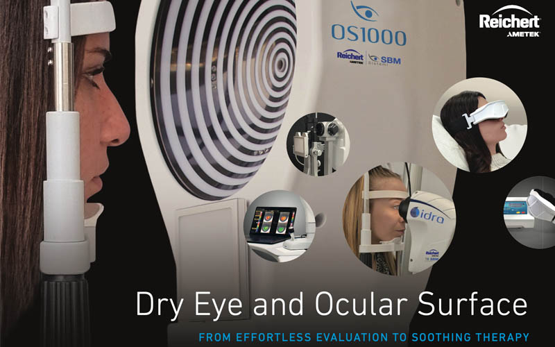 Ocular Surface and Dry Eye Technology from Reichert® | SBM