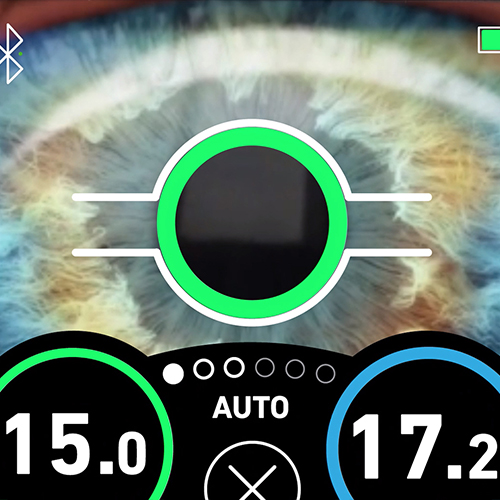 Tono-Vera® Tonometer - Truly Objective | Coming Soon from Reichert®