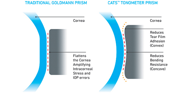The New Shape of IOP.